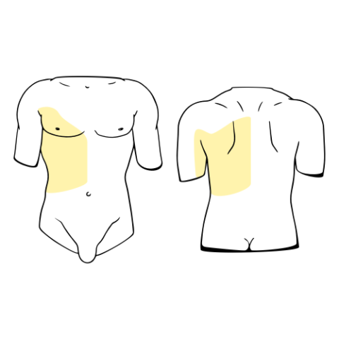 Erector Spinae | Nerve Block